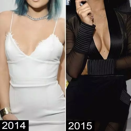 15 foto che dimostrano che i cambiamenti di Kylie sono MOLTO più drastici di quanto pensi 14085_15