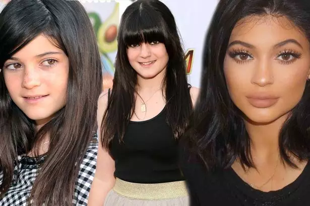 15 foto che dimostrano che i cambiamenti di Kylie sono MOLTO più drastici di quanto pensi 14085_3