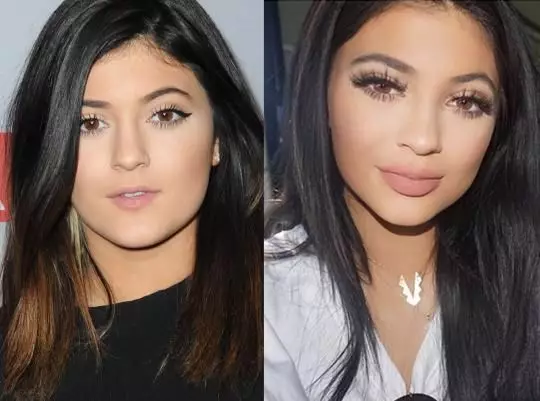 15 fotografii care dovedesc că schimbările lui Kylie sunt MULT mai drastice decât crezi 14085_4