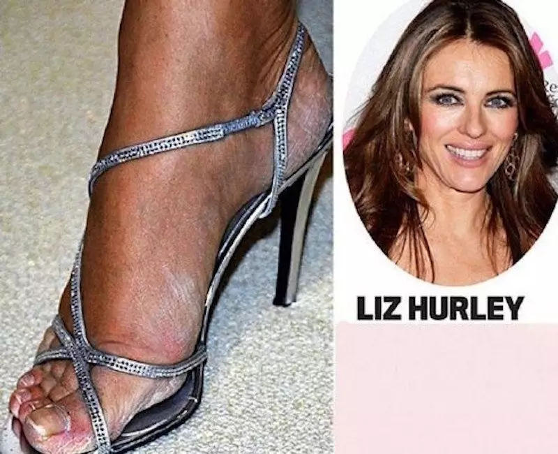 14 celebridades com as piores pedicures 17247_10