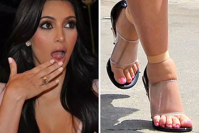 14 celebridades com as piores pedicures 17247_3