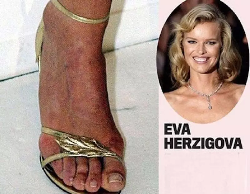 14 celebridades com as piores pedicures 17247_4