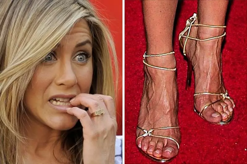 14 celebridades com as piores pedicures 17247_5