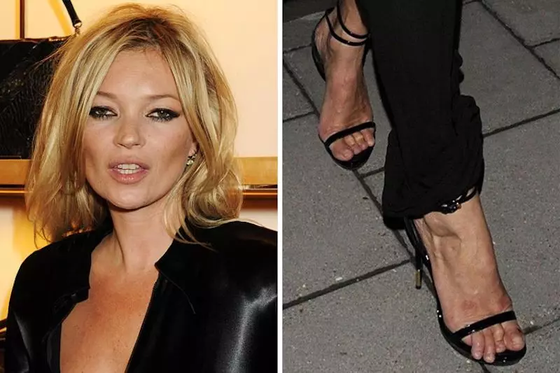 14 celebridades com as piores pedicures 17247_6