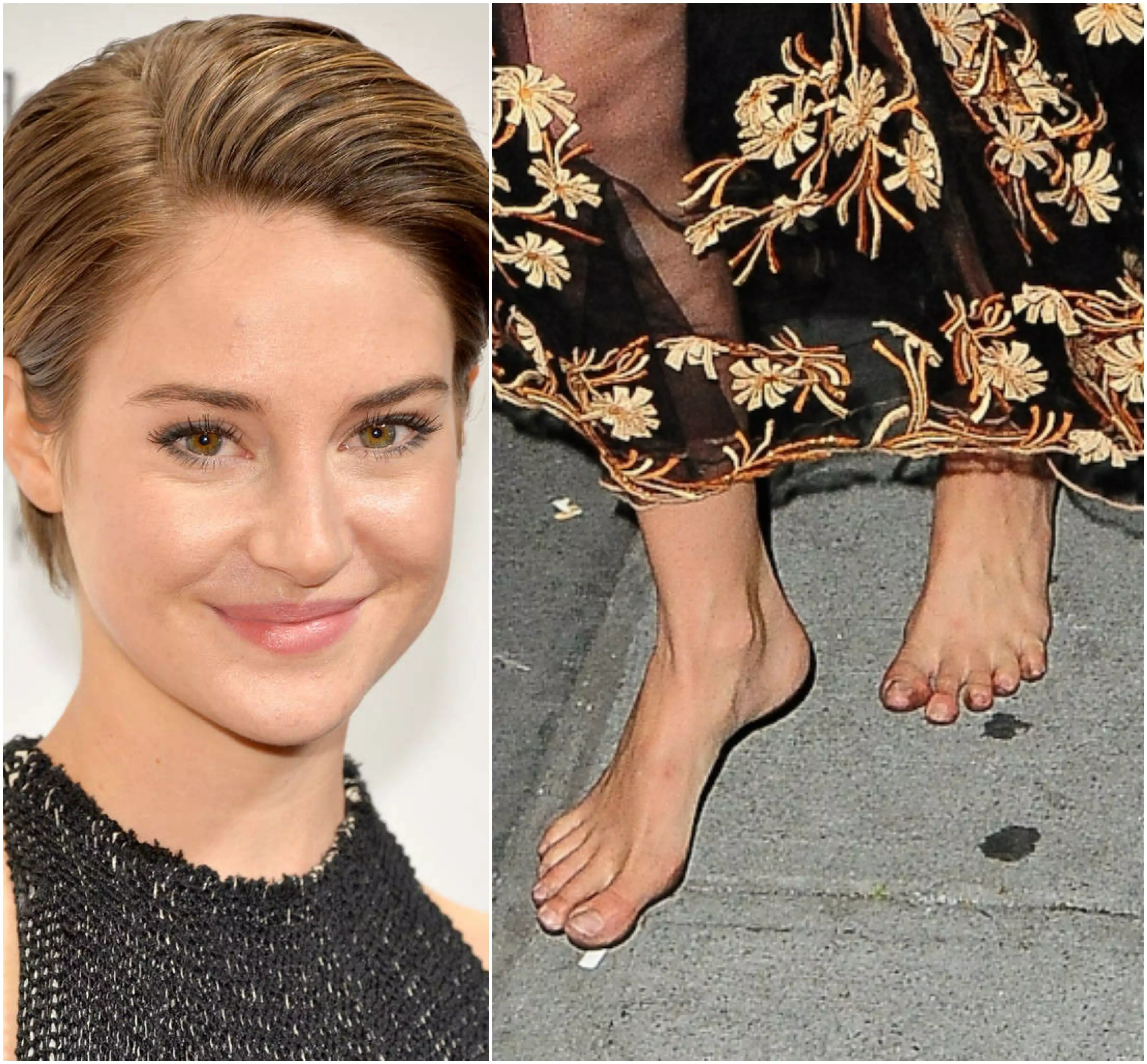 14 celebridades com as piores pedicures 17247_8