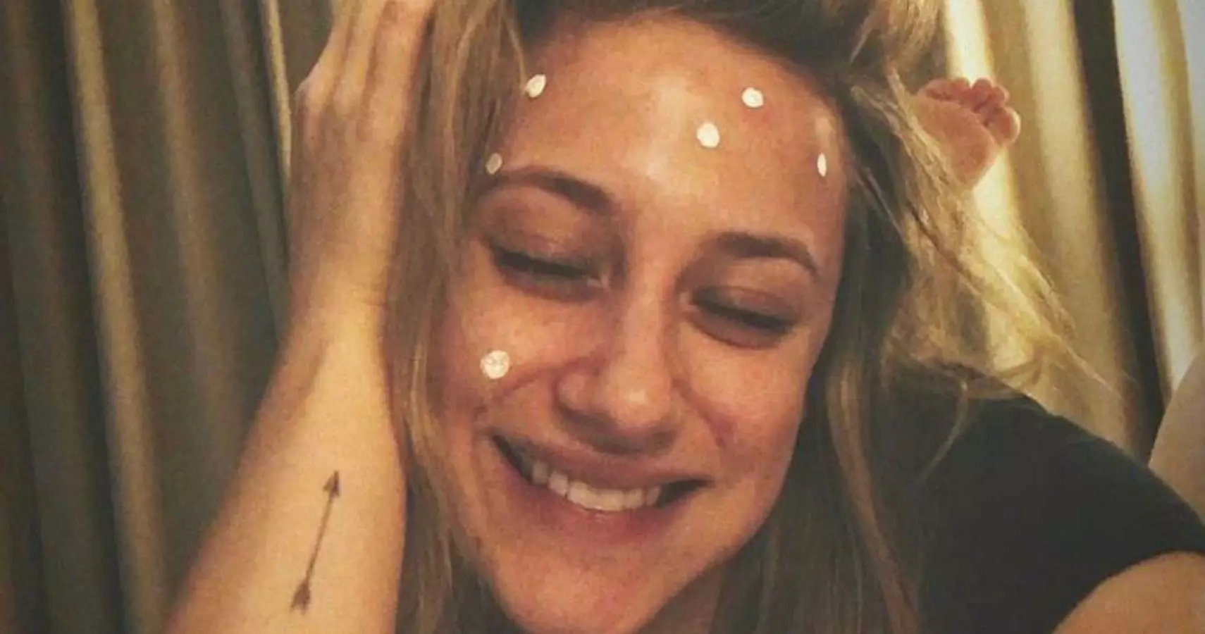 Lili Reinhart usa Instagram para discutir luta com acne 7296_0