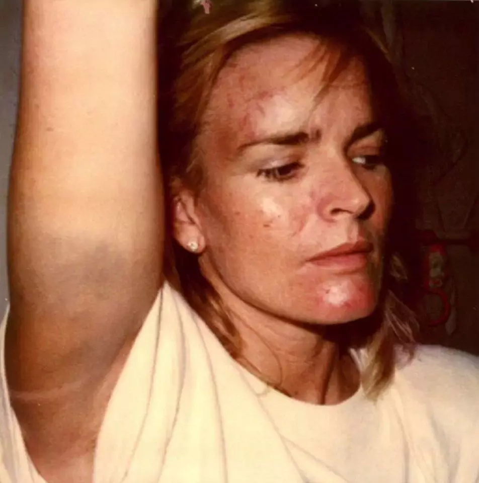 Fotot e Jetës së Nicole Brown Simpson para vrasjes së saj 9853_10